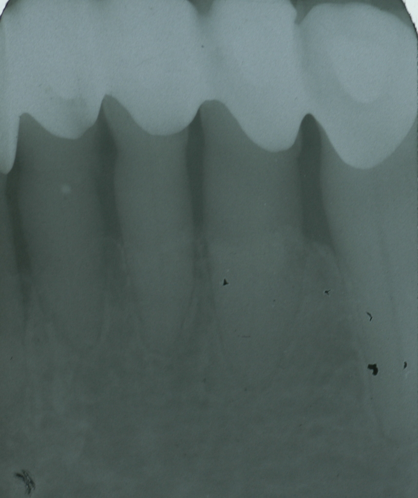 HANDBOOK OF ADHESIVE BRIDGES - Peter Walford Dentistry
